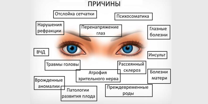 Диплопія монокулярна та бінокулярна – ознаки та як лікувати вправами